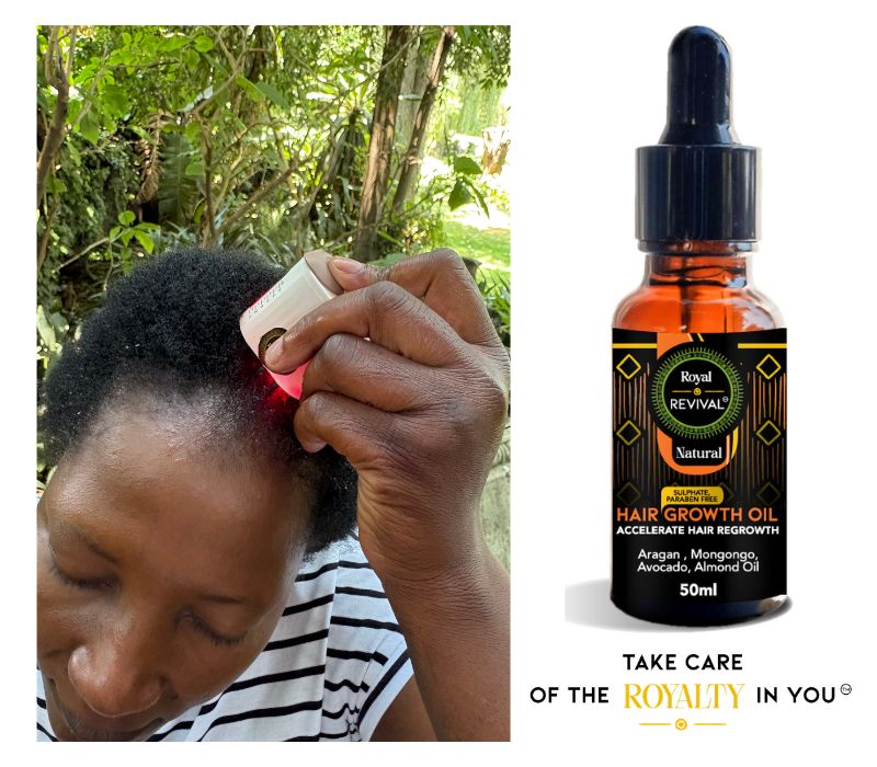 Accelerate Hair Growth Oil & Red Light Therapy Vibrating Fluid ...